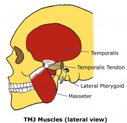 측두근 건염 (Temporalis tendonitis) - 턱관절 통증, 입 안벌어짐 - 서울구강내과치과 : 네이버 블로그