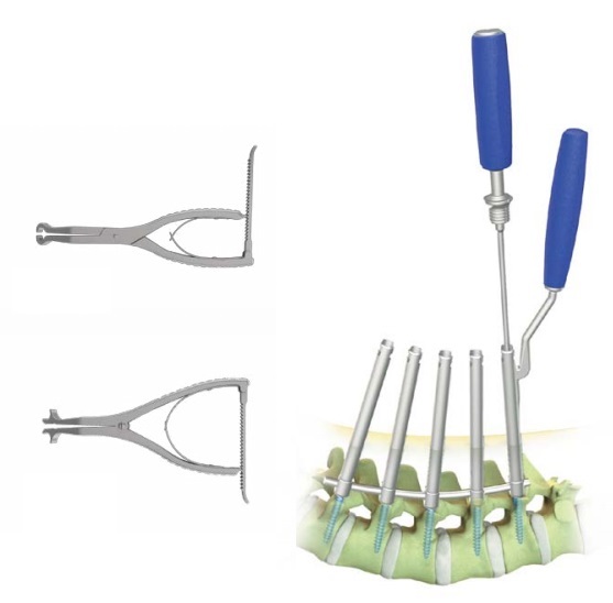 TLIF - Perfix spine system : 네이버 블로그