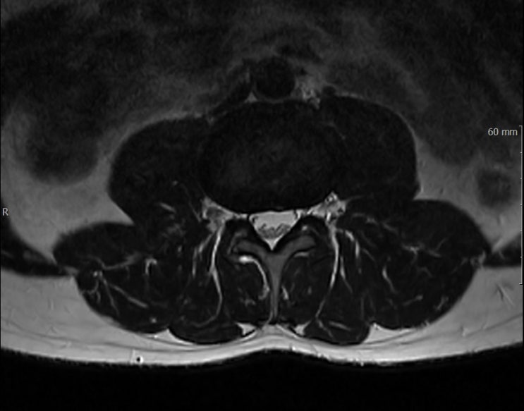 MRI 검사의 Matrix설정 : 네이버 블로그