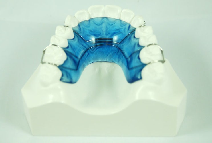 Hawley Retainer, Wrap-around Retainer: 치아교정 유지장치 : 네이버 블로그