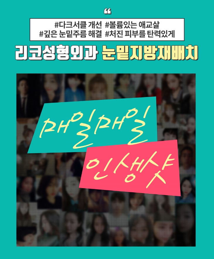 눈밑필러 부작용 걱정없이 눈밑지방재배치 : 네이버 블로그