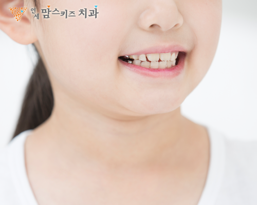 포천어린이치과 법랑질 형성부전증이란 원인과 치료방법 네이버 블로그