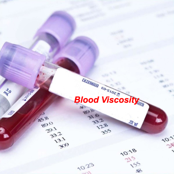 혈액점도검사(blood viscosity test) 이론과 실제 : 네이버 블로그