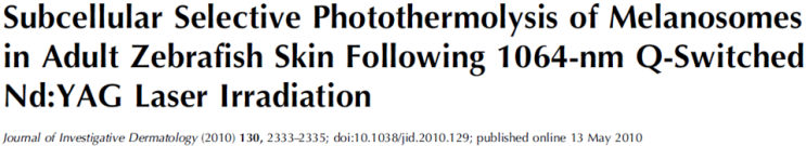 Subcellular selective photothermolysis of melanosomes in adult ...