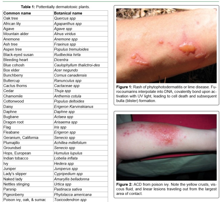 phytodermatitis : 네이버 블로그