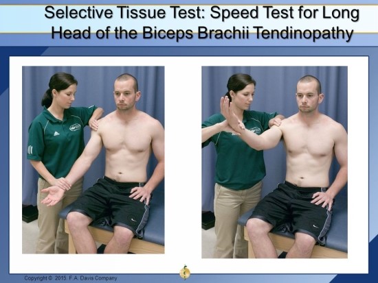 스피드 테스트(Speed's test - Biceps or straight arm test) : 네이버 블로그