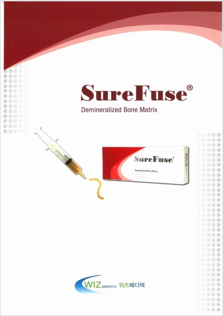 SUREFUSE : 네이버 블로그