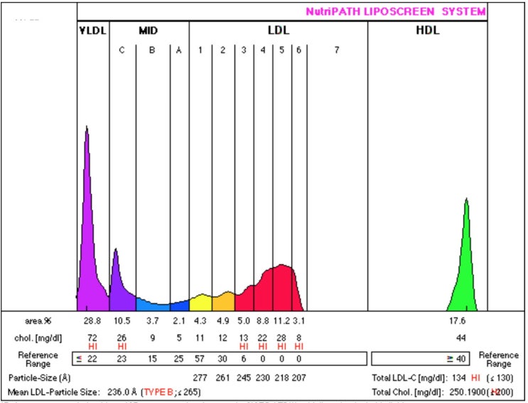 sdLDL =Small Dense LDL (저밀도 지단백) : 네이버 블로그