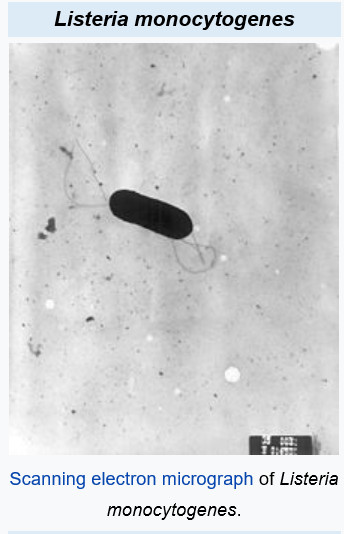Listeria monocytogenes infection(리스테리아 감염증) : 네이버 블로그