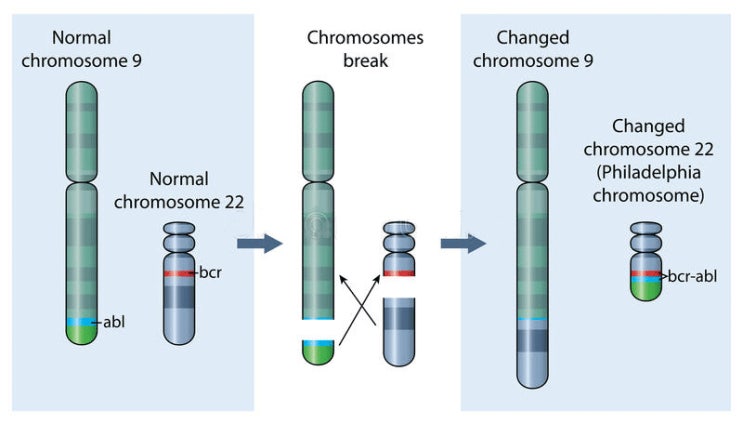 필라델피아 염색체(Philadelphia chromosome, Ph) 발전사 : 네이버 블로그