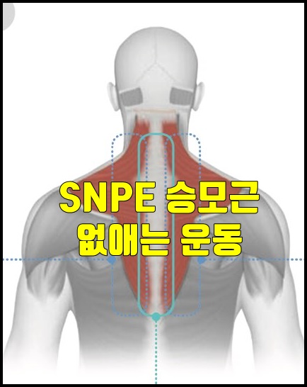SNPE운동>승모근 없애는 T무브 다양한 도구 활용/어깨, 등, 목 경직, 거북목, 일자목 완화 : 네이버 블로그