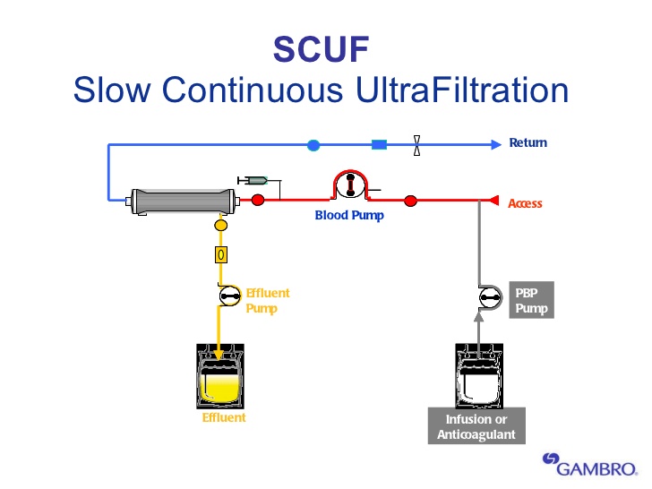 CRRT mode/CRRT 모드/SCUF/CVVH/CVVHD/CVVHDF/CRRT 적용 : 네이버 블로그