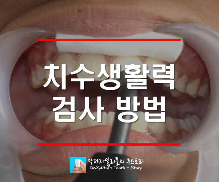 치아 치수생활력 검사 치아신경 반응검사 방법들 치수괴사 진단 신경이 살아있어요 죽어있어요 By 닥터