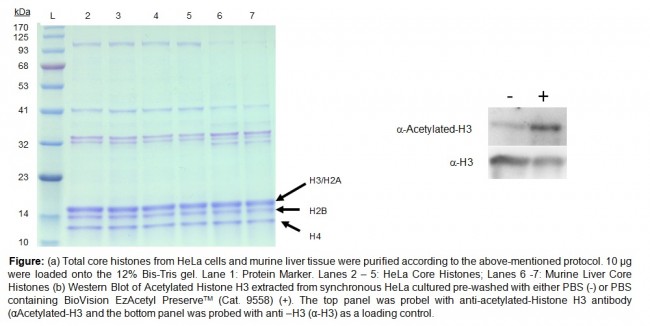 [중심 히스톤/핵심히스톤 분리 키트][Cell Fractionation Kits] EZExtract™ Core Histone ...