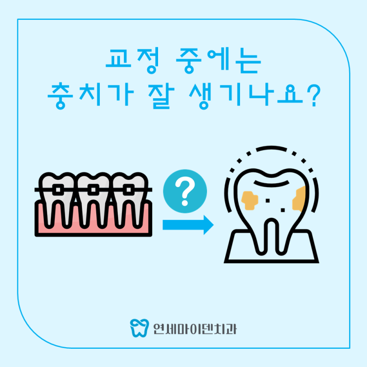 치아교정 중에는 충치 발생 확률이 높은가요 교정 중 충치 관리 네이버 블로그