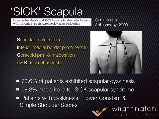 "SICK scapular syndrome"을 아십니까? : 네이버 블로그
