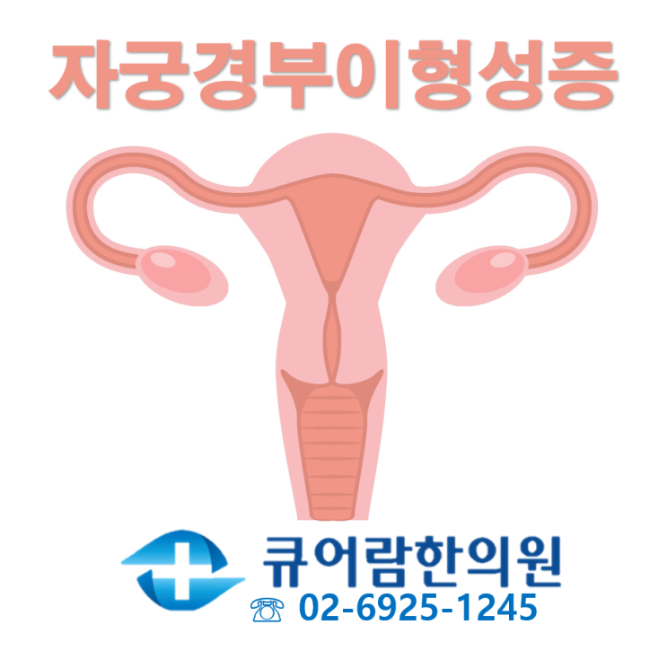 자궁경부이형성증 단계별 집중치료의 핵심 네이버 블로그