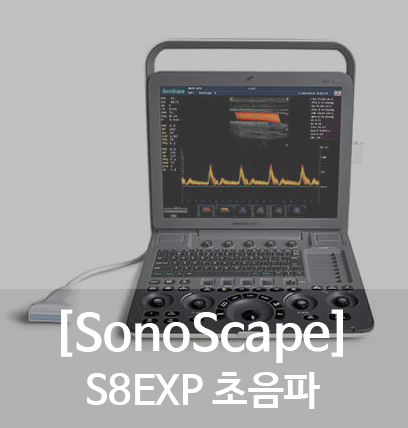 소노스케이프 S8EXP 초음파 (주)유티비 : 네이버 블로그