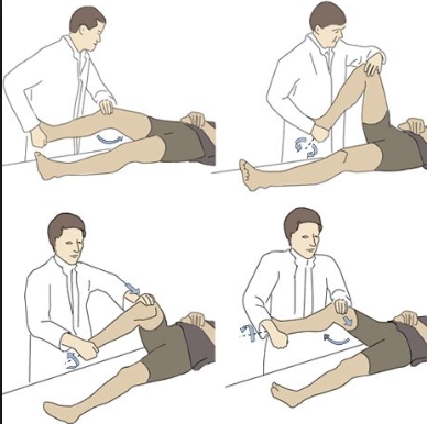 무릎 반월판 손상 테스트 맥머레이 테스트 McMurray test : 네이버 블로그