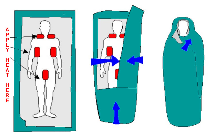 질병외-비외상성-한랭손상-저체온증 : 네이버 블로그
