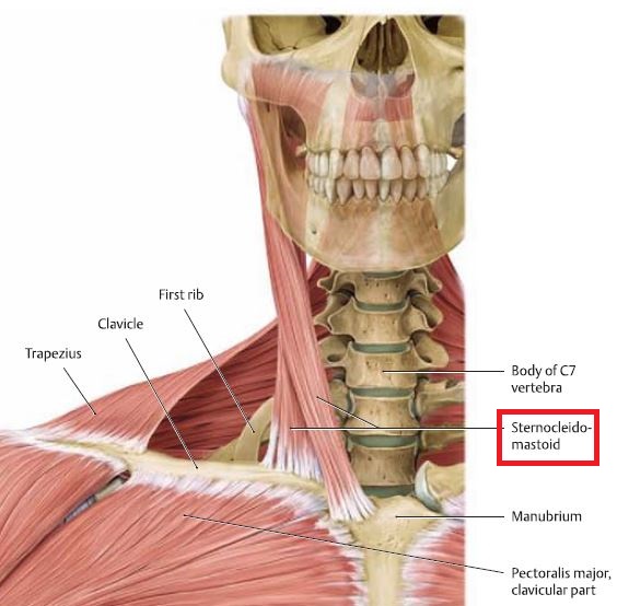 흉쇄유돌근 이야기 (SCM, sternocleidomastoid muscle) / 몸편한재활의학과 : 네이버 블로그