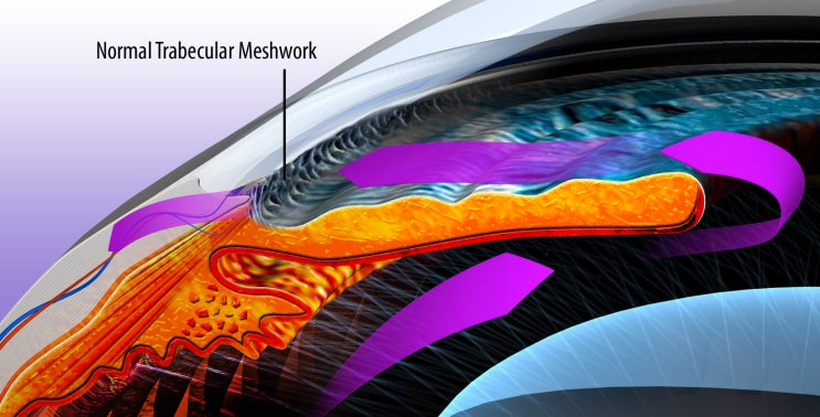 섬유주(trabecular meshwork) : 네이버 블로그