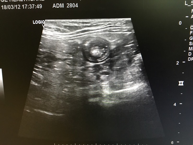 고양이 헤어볼 수술 : 네이버 블로그