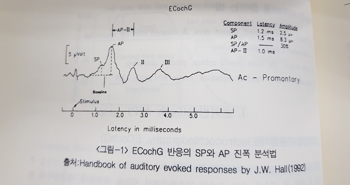 전기달팽이관검사 ECochG : 네이버 블로그