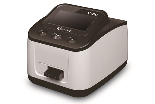 의료장비 도입 - VCHECK V100 : 네이버 블로그