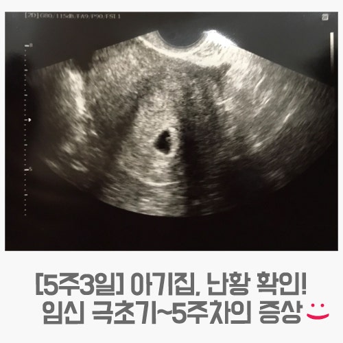 [5w3d]아기집, 난황 확인! 임신 극초기~5주차까지의 증상 : 네이버 블로그