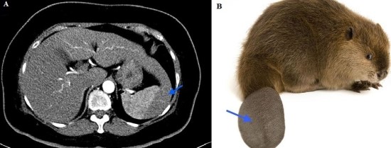 [Liver] Beaver Tail Liver : 네이버 블로그