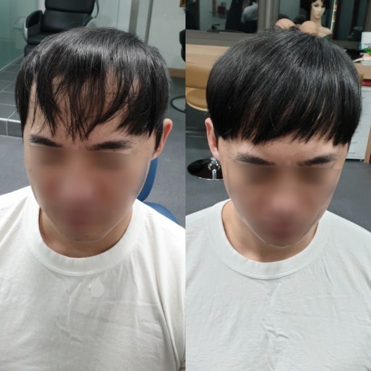 홍대 헤어 증모술 남자 숱없는 앞머리 붙임머리 시술정보 네이버 블로그