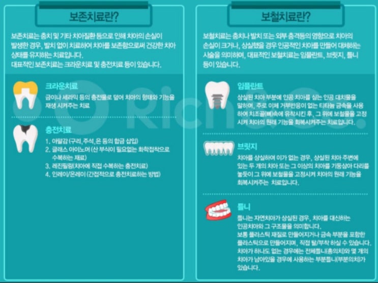 메리츠화재 치아보험 저렴한 보험료 큰 보장 보존보철 치료 네이버 블로그