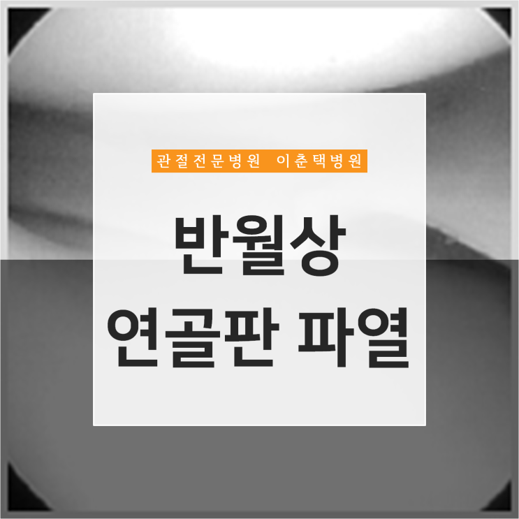 수원 정형외과 무릎연골손상 증상은 관절내시경으로 반월상연골판 파열 치료 네이버 블로그