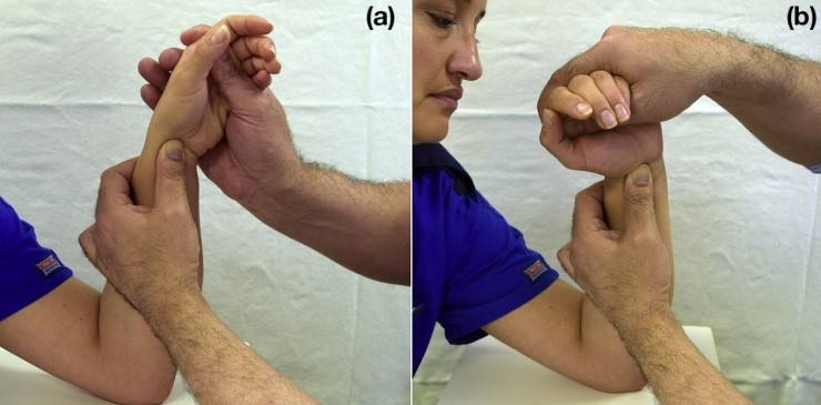 [손목] Scapholunate dysfunction & SLAC wrist : 네이버 블로그