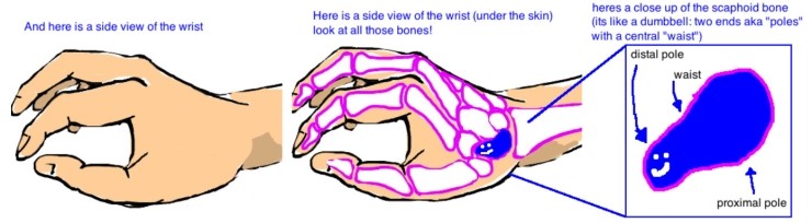 scaphoid fracture (주상골 골절) : 네이버 블로그