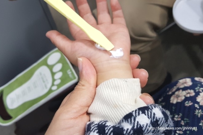 아기손바닥 가시빼기, 역시 병원이 최고! : 네이버 블로그