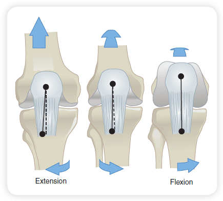 '무릎관절 screw-home mechanism과 관절의 정적/동적 안정성' : 네이버 블로그