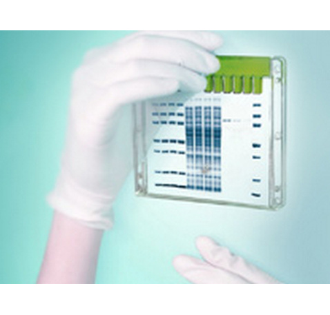 뛰어난 해상도와 일관성 있는 결과를 보장하는 GenScript SurePAGE™ Bis-Tris gel : 네이버 블로그