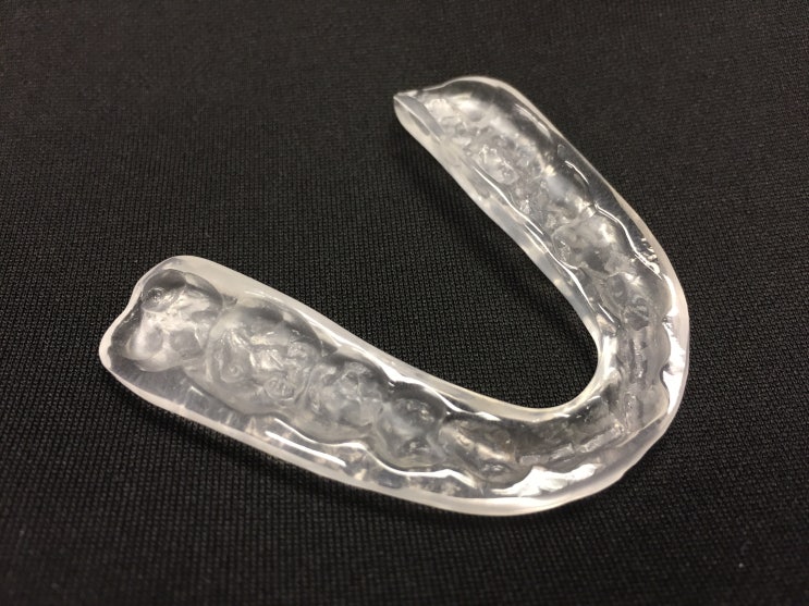 턱관절치료를 위한 교합안정장치(Occlusal stabilization splint) : 네이버 블로그