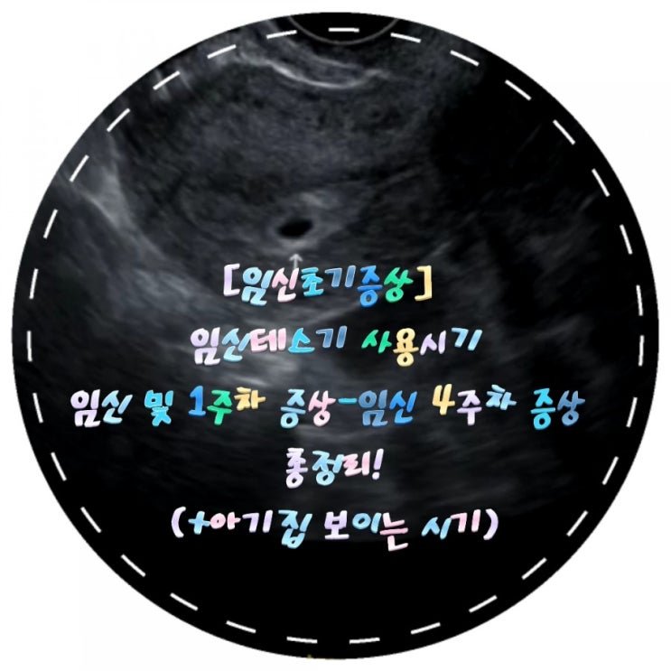 임신초기증상 임신테스트기 사용시기임신1주차 증상 임신 4주차 증상 총정리아기집 보이는 시기 네이버 블로그