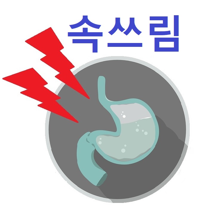 ♥잠실한의원♥소화불량 역류성 식도염 위염 속쓰림 명치통증 소화과정송 위장병에 뜸이 참 좋습니다 네이버 블로그