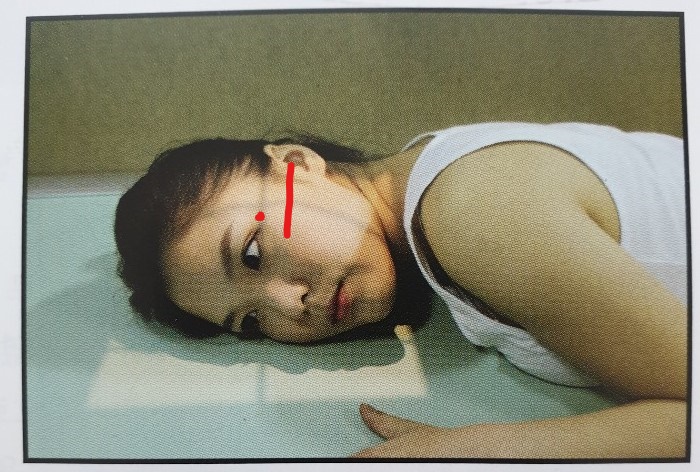 orbit lateral projection : 네이버 블로그