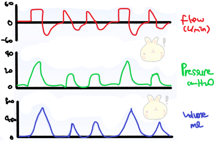 Ventilator(기계호흡): SIMV (Synchronized Intermittent Mandatory Ventilation ...