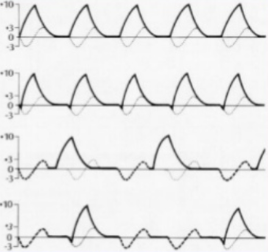 인공호흡기(ventilator): IMV(intermittent mandatory ventilator) mode : 네이버 블로그