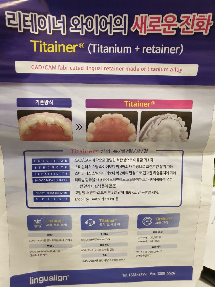 Titainer (titanium retainer) 티타늄 리테이너 : 네이버 블로그