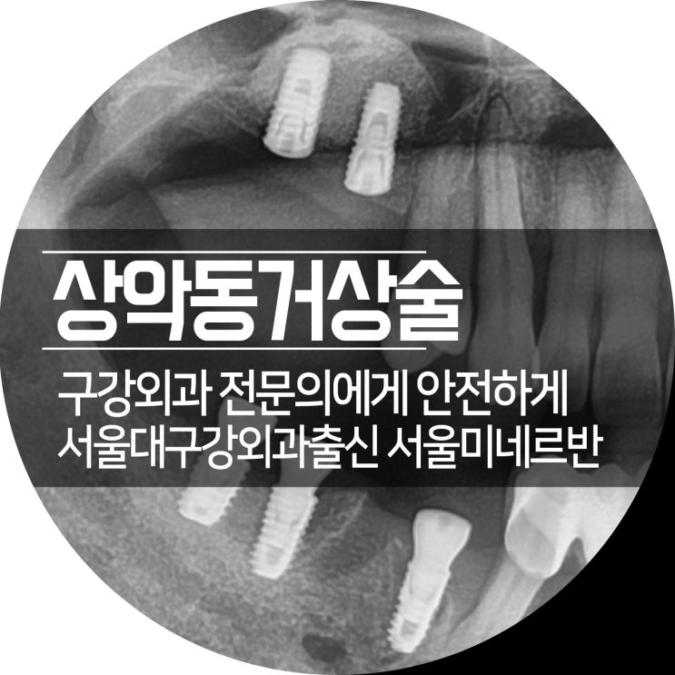 상악동거상술 구강외과전문의 에게 안전하게 네이버 블로그