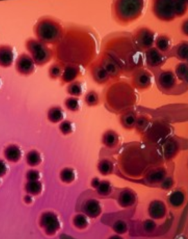 M chimaera 수술부위 감염 : 네이버 블로그