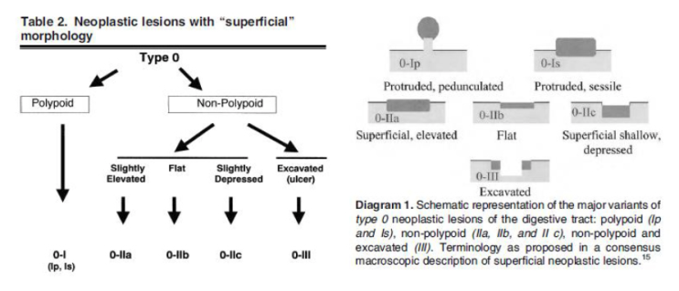 Paris classification system of superficial gastrointestinal neoplastic ...