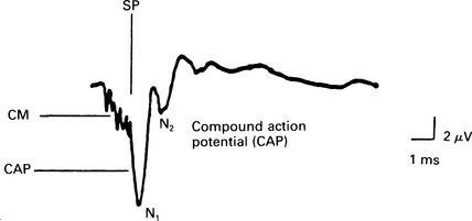 포천보청기 / 전기와우도검사(EcochG) : 네이버 블로그